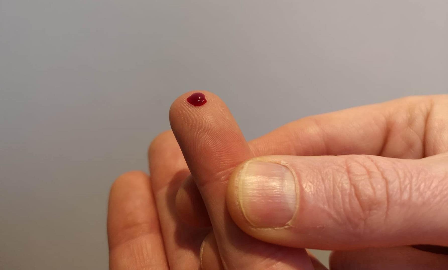 SKB-test - Natuurlijk Welzijn