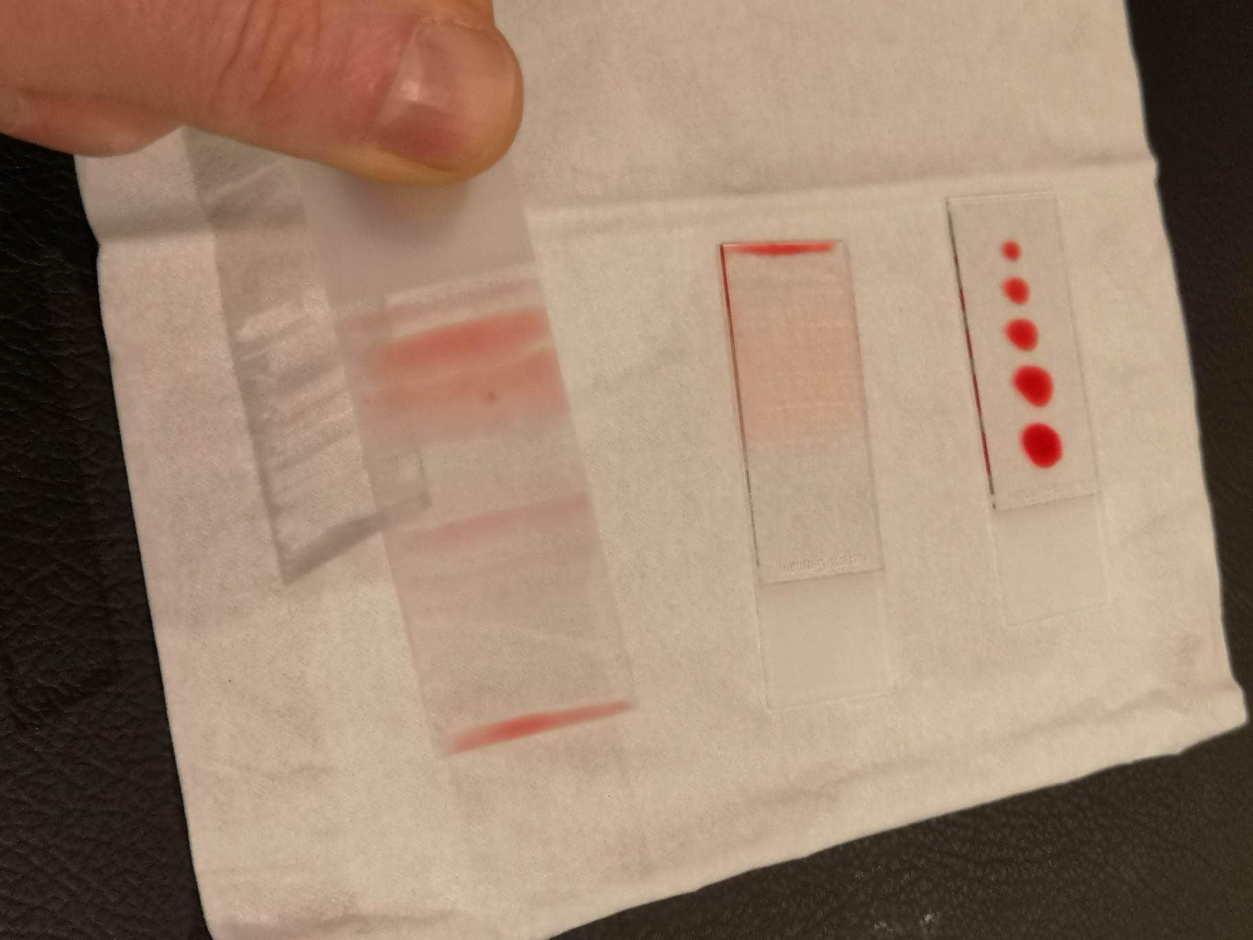 SKB-test - Natuurlijk Welzijn